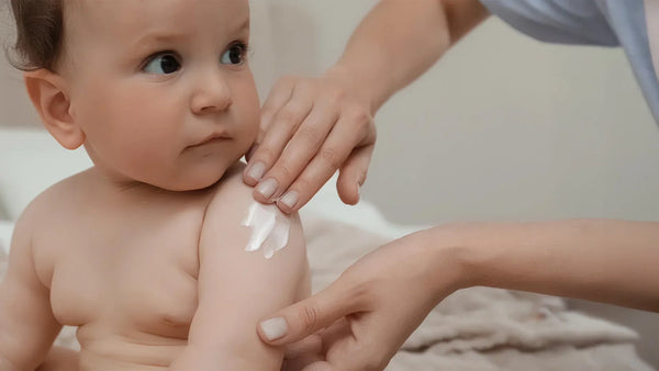 How to Choose the Right Cream for Your Baby's Itchy Skin - Baby Forest